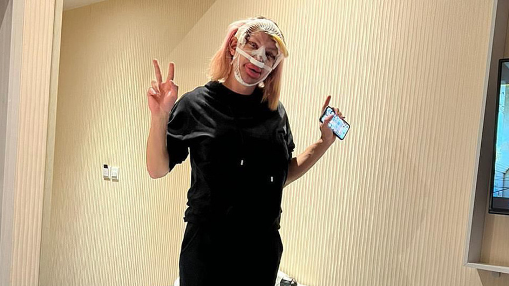 Jan Šimša: Promluvil o drastické rekonstrukci obličeje – eXtra.cz