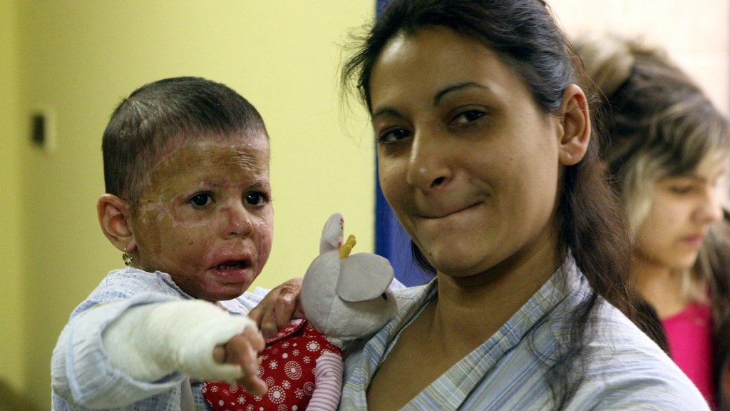 Natálka Siváková: Ze žhářů má strach, bere antidepresiva