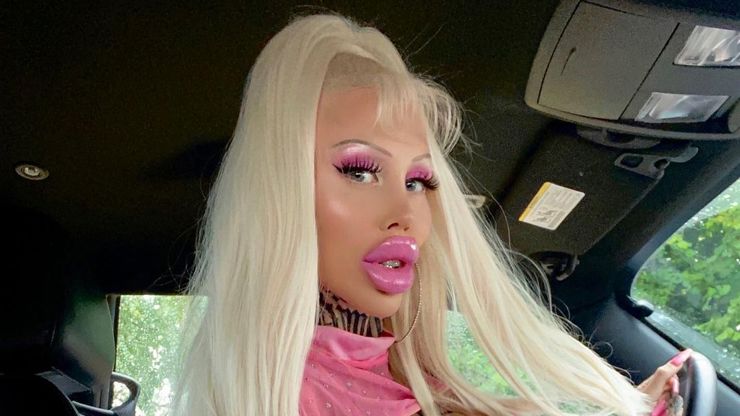 Galerie: Alicia Almira se proměnila v lidskou Barbie: Miluje plastiky a ...