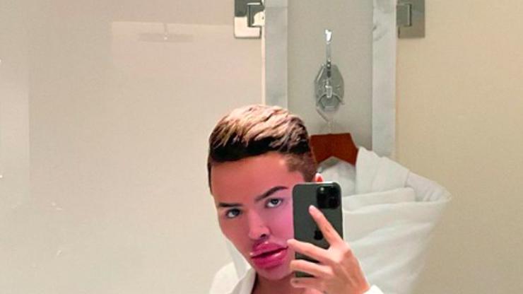 Galerie: Mateo Blanco: Harazd se zdravím kvůli touze po dokonalosti ...