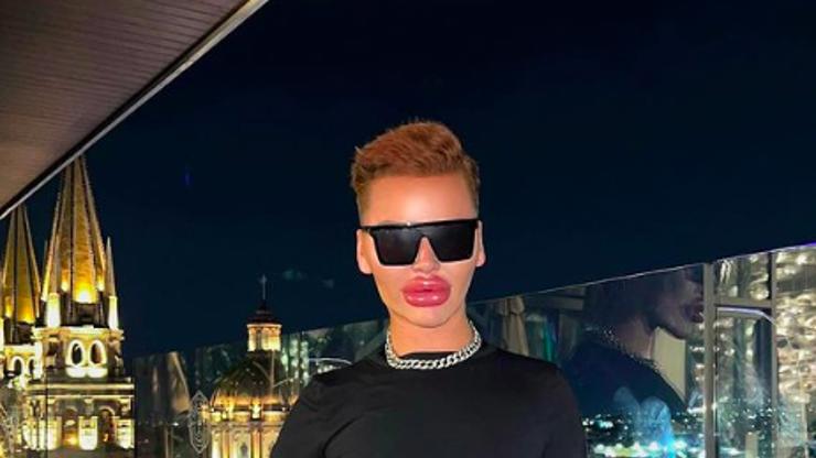 Galerie: Mateo Blanco: Harazd se zdravím kvůli touze po dokonalosti ...