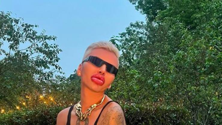 Galerie: Mateo Blanco: Harazd se zdravím kvůli touze po dokonalosti ...