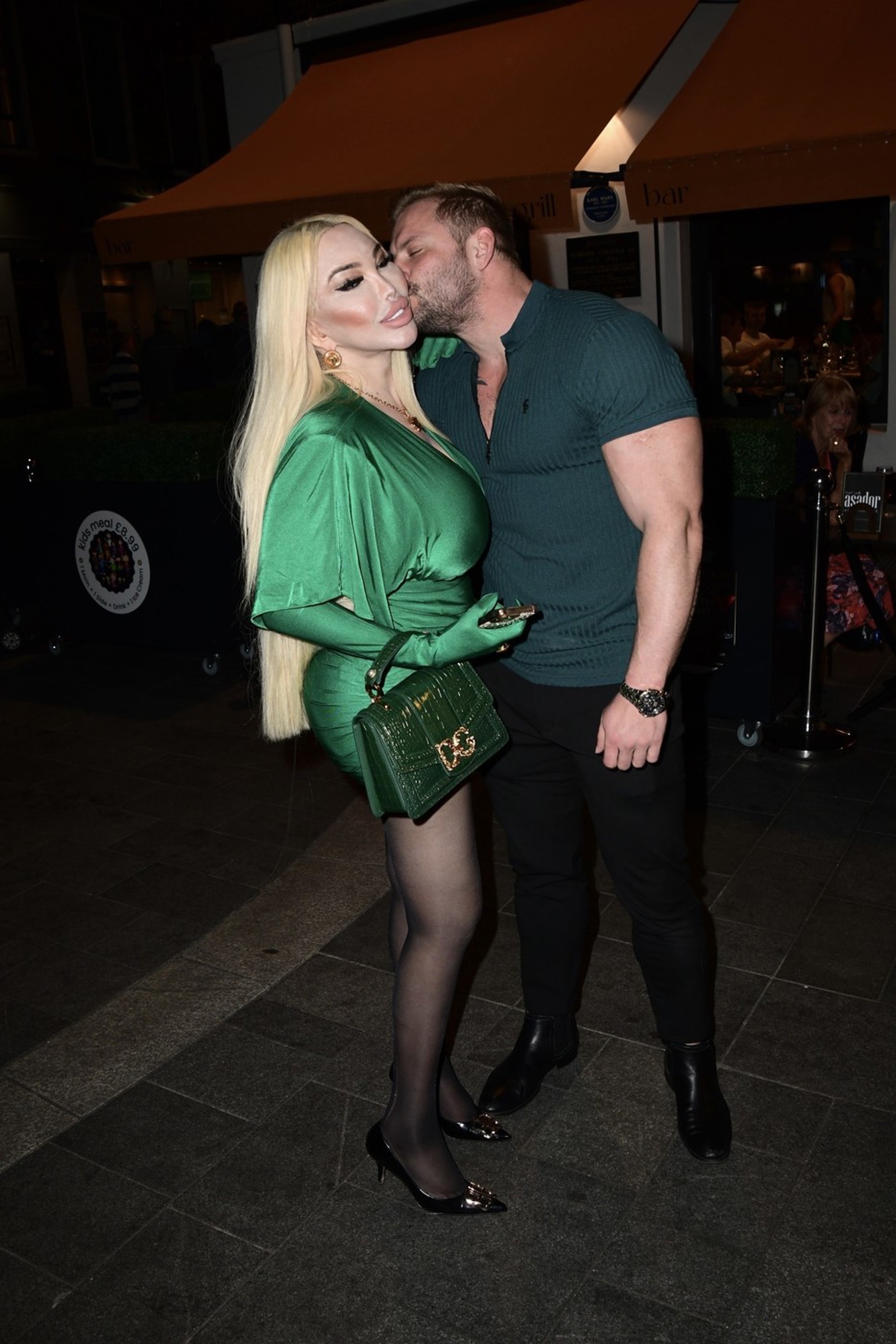 Galerie: Nepovedené plastiky: Jessica Alves po jedné málem zemřela ...