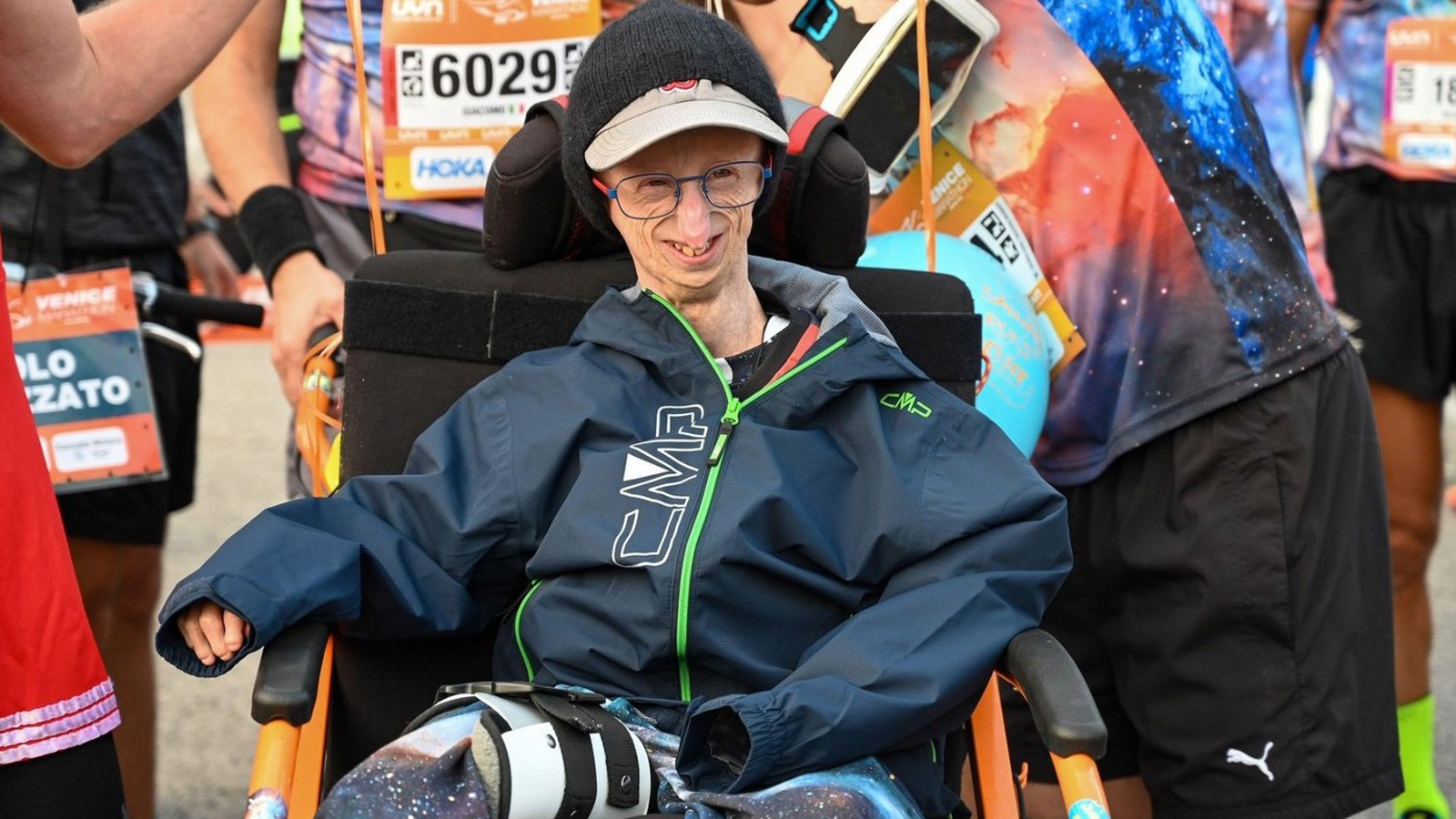 Sammy Basso zemřel ve 28 letech: Trpěl progerií, kvůli které rychle stárnul