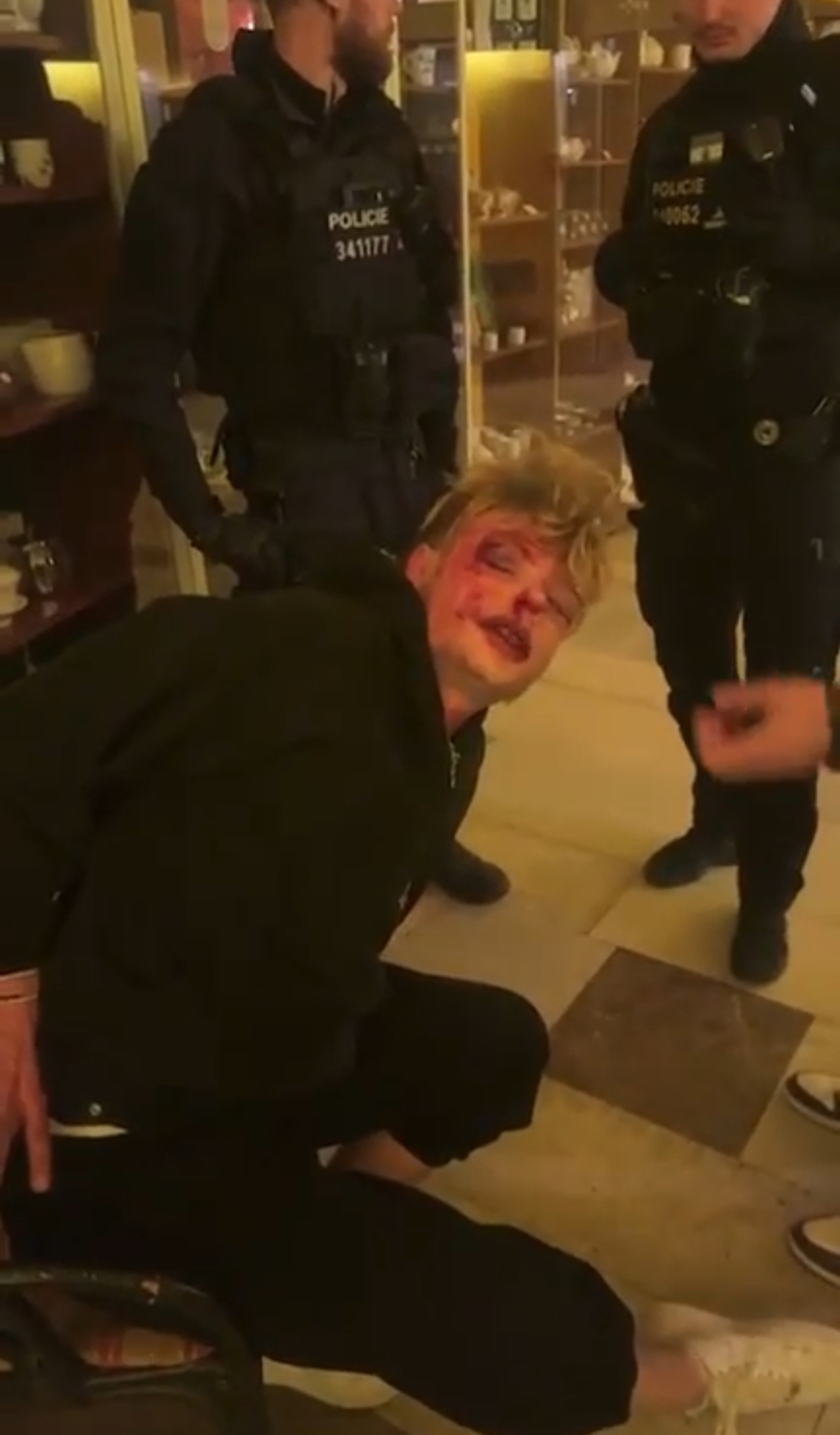 Galerie: Napadení: Rapper IAM Oskar skončil s monokly po rvačce s ...