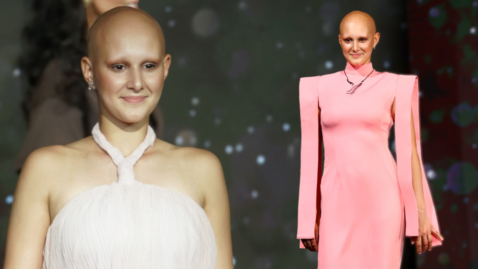 Čtrnáctiletá modelka s alopecií: Vlasy mi začaly vypadávat už ve třech ...